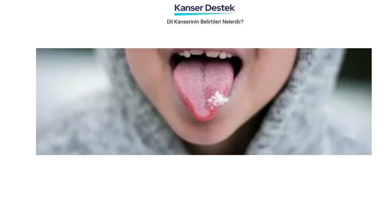 Dil Kanseri Neden Olur?